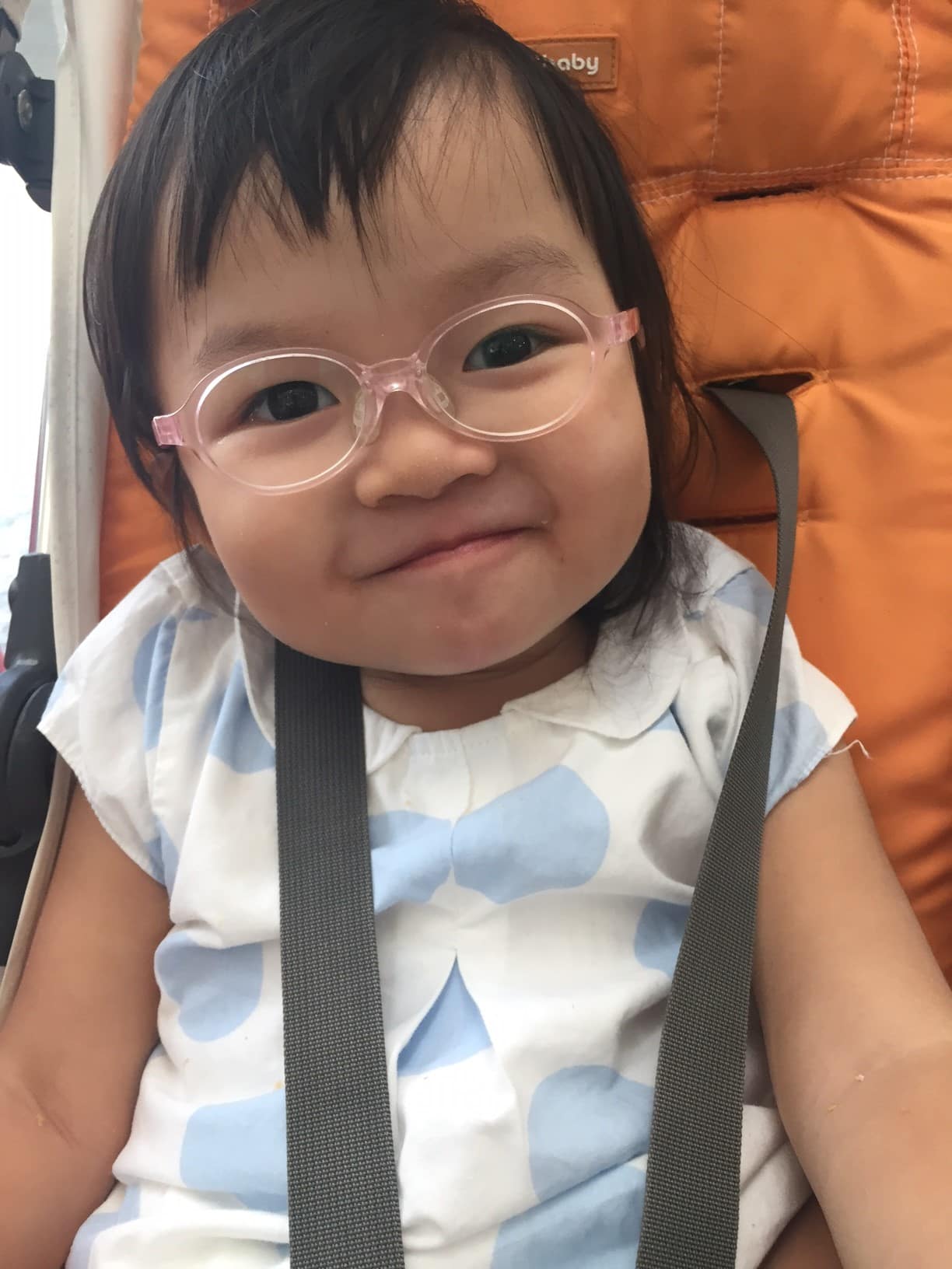 Pediatric Keratoplasty Association - Dr. Gerald Zaidman